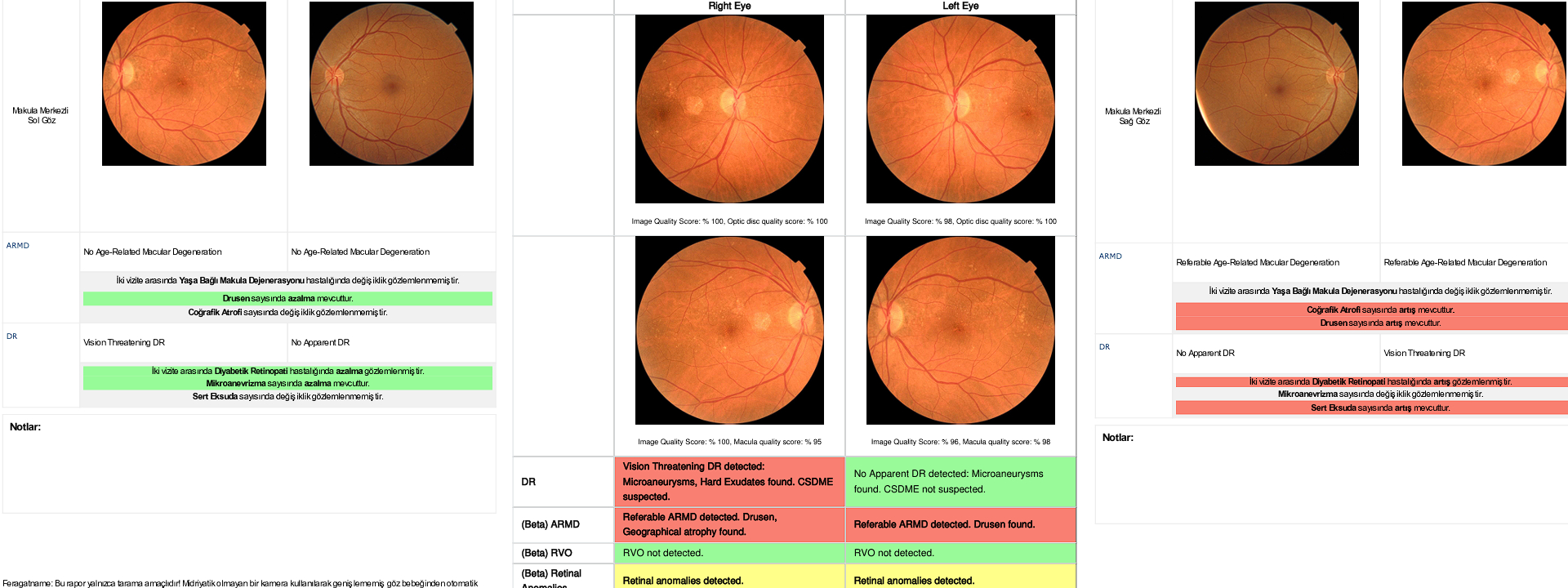 EyeCheckup – Early Diagnosis AI System