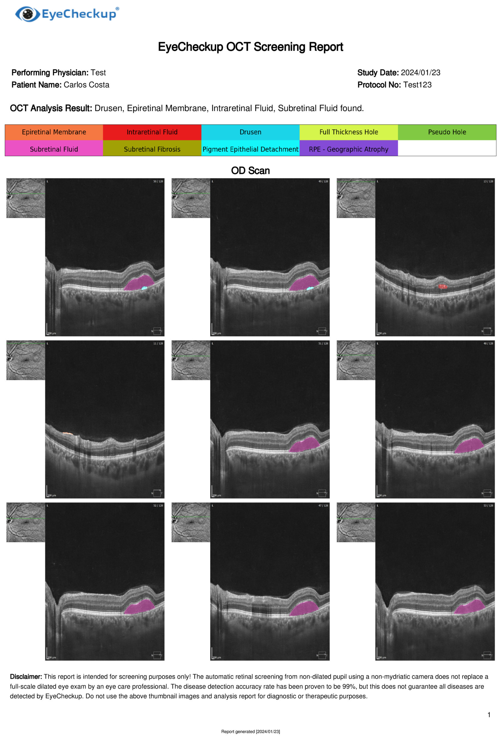 EyeCheckup – Early Diagnosis AI System